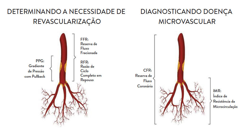 Coroflow 3.7 - Brasil