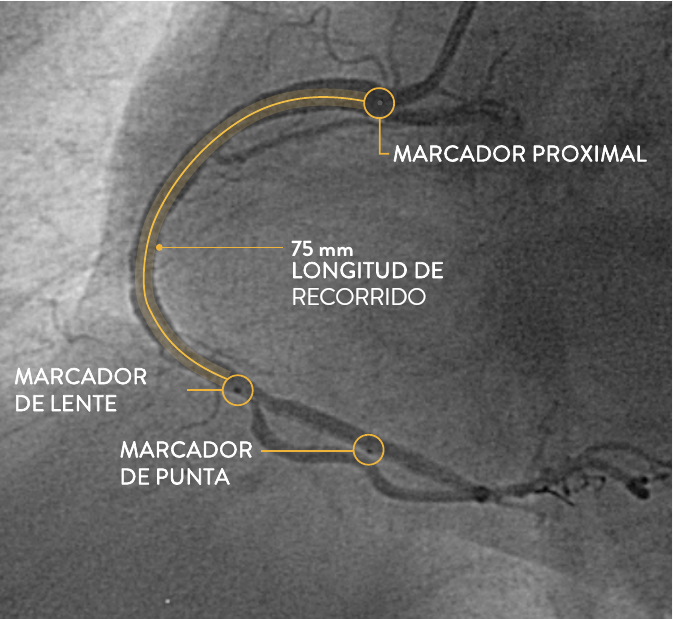 Catéter De Imagen Dragonfly OpStar™ - Mexico