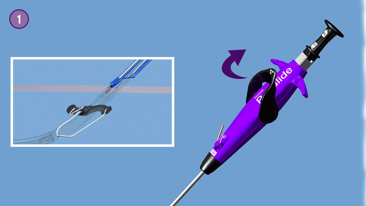 Perclose ProGlide Vascular Closure | Percutaneous Repair